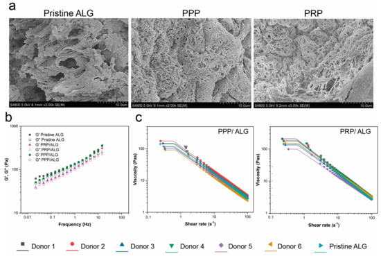 Plasma-Based Bioinks for Extrusion Bioprinting of Advanced Dressings