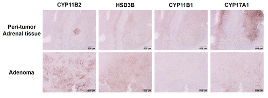 Pathophysiological and Pharmacological Characteristics of KCNJ5 157-159delITE Somatic Mutation ...