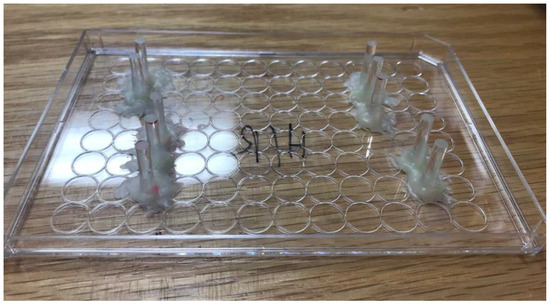 Poloxamer 188 Exerts Direct Protective Effects on Mouse Brain ...