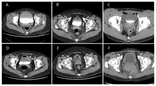 Biomedicines | Special Issue : Bladder Dysfunction: From Molecular ...