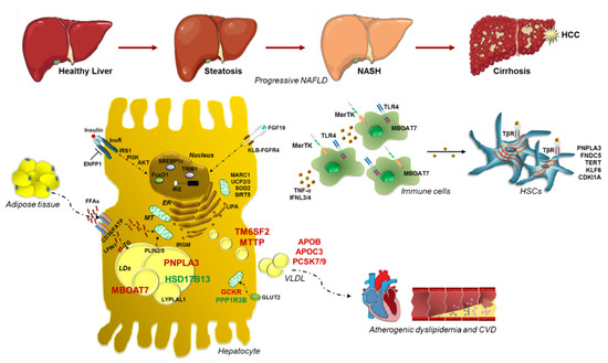 Genetics Is of the Essence to Face NAFLD