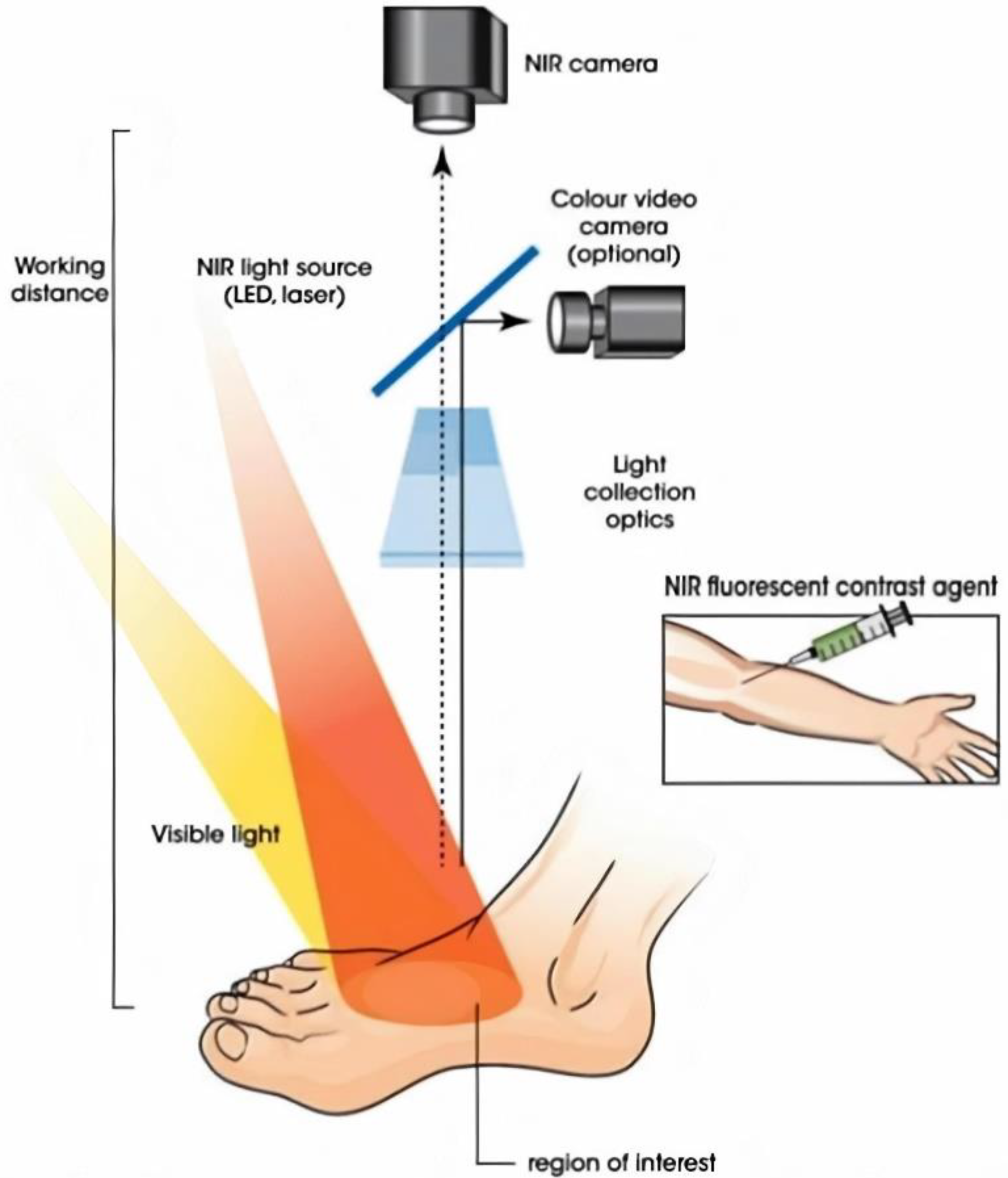 Perfusion Patterns in Patients with Chronic Limb-Threatening Ischemia ...