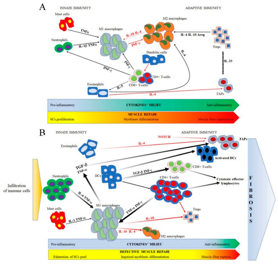 The Immune System in Duchenne Muscular Dystrophy Pathogenesis