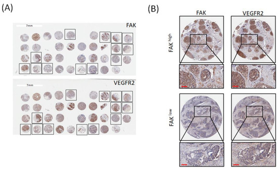 FAK Regulates VEGFR2 Expression and Promotes Angiogenesis in Triple ...