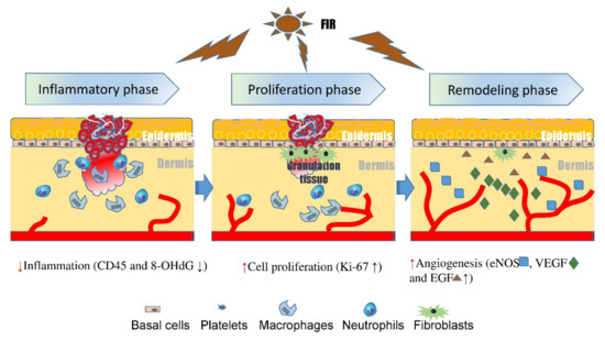 Far-Infrared Therapy Accelerates Diabetic Wound Healing via Recruitment ...