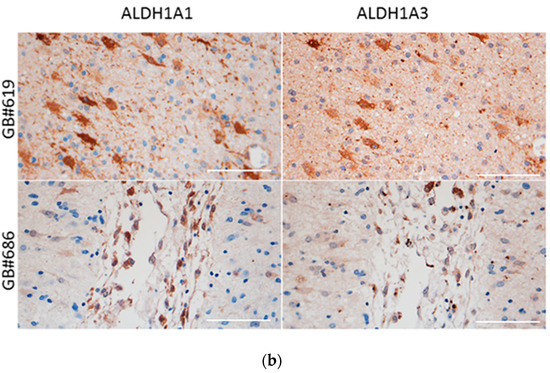 ALDH1A3 Segregated Expression and Nucleus-Associated Proteasomal ...