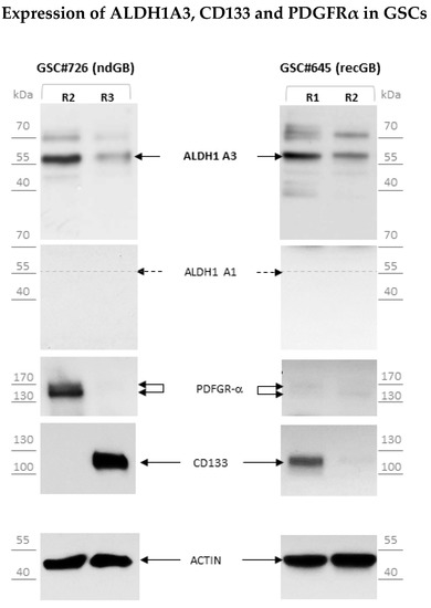 ALDH1A3 Segregated Expression and Nucleus-Associated Proteasomal ...