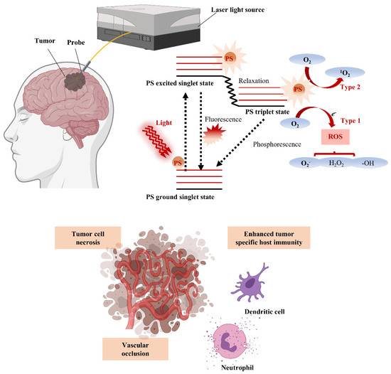 Brain Cancer Cell Diagram
