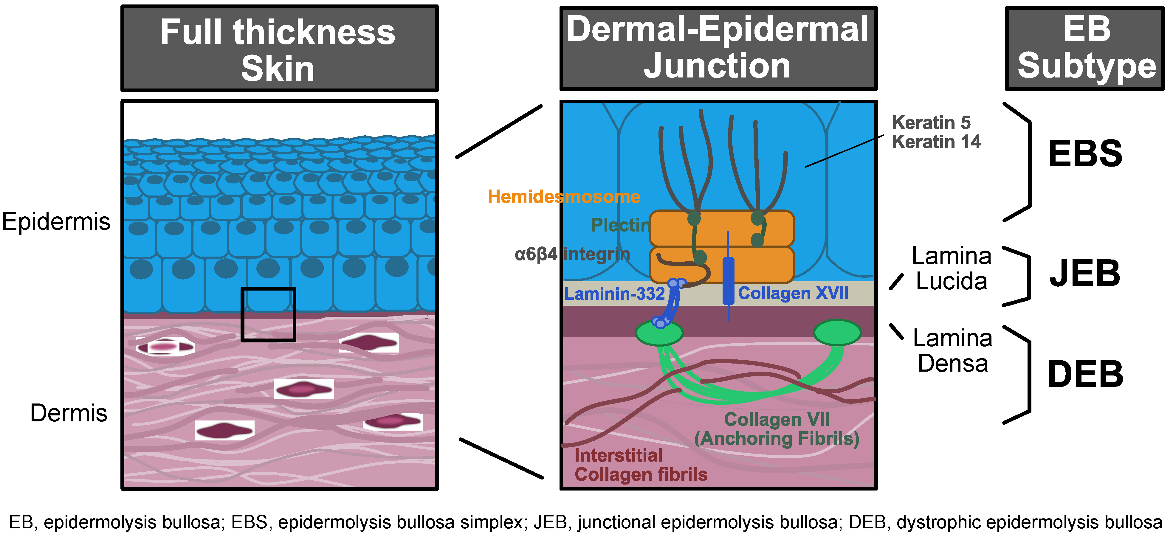 Epidermolysis Bullosa Pictures