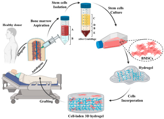 Immunomodulation of Skin Repair: Cell-Based Therapeutic Strategies for ...