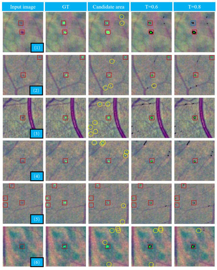 Biomedicines | Free Full-Text | Local Structure Awareness-Based Retinal Microaneurysm Detection ...