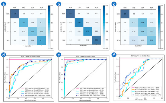 An Artificial Intelligence-Enabled ECG Algorithm for the Prediction and Localization of ...
