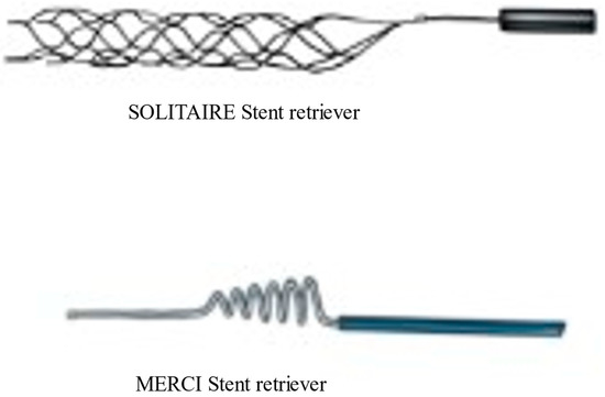 Endovascular Intervention in Acute Ischemic Stroke: History and Evolution