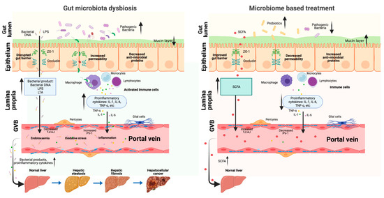 The Role of Gut–Liver Axis in Gut Microbiome Dysbiosis Associated NAFLD and NAFLD-HCC