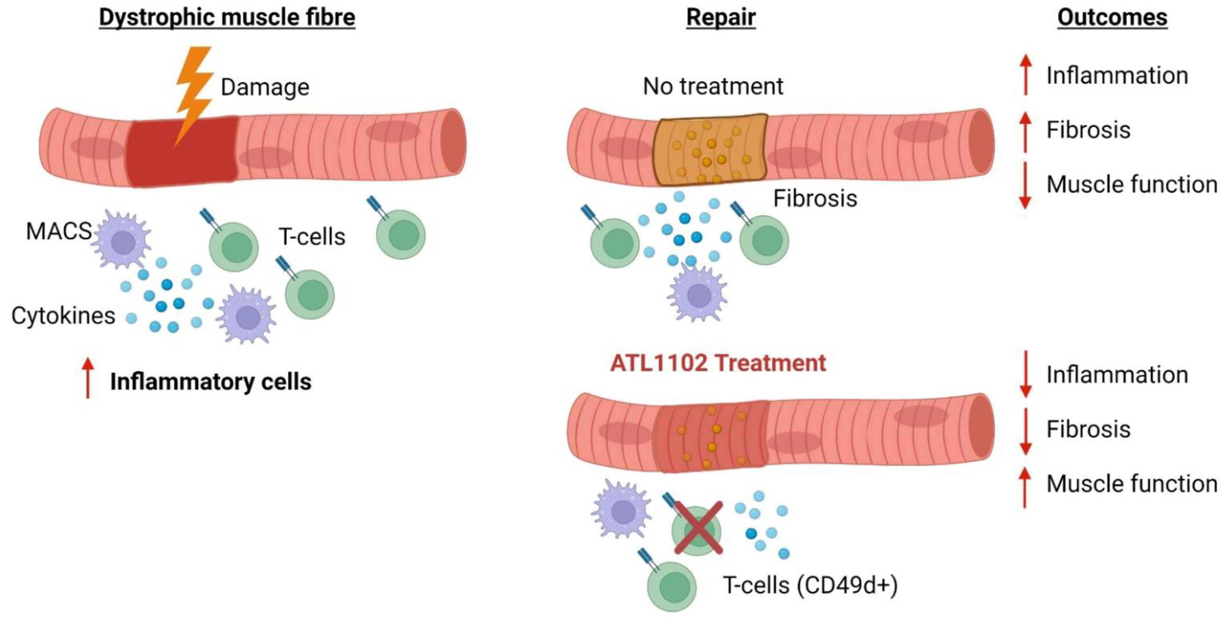 A Spotlight on T Lymphocytes in Duchenne Muscular Dystrophy—Not Just a ...
