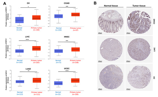 An Integrative Pan-Cancer Analysis of Kinesin Family Member C1 (KIFC1 ...