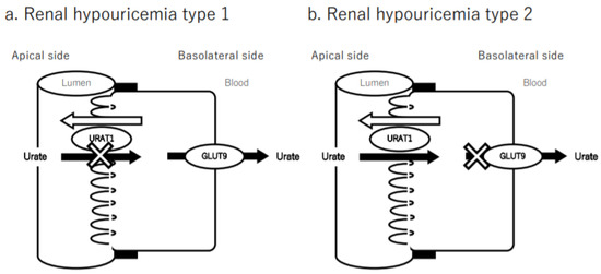 Hypouricemia and Urate Transporters