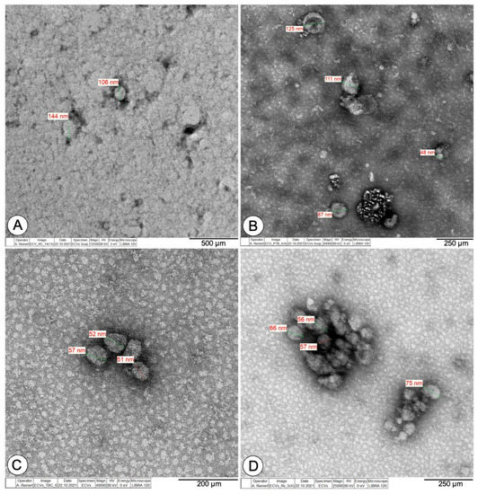 Mycobacterium tuberculosis Affects Protein and Lipid Content of ...