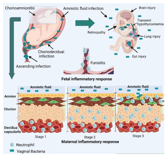 Animal Models of Chorioamnionitis: Considerations for Translational ...