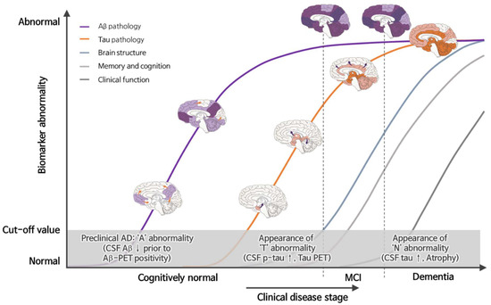 Biomedicines Free Full Text Development Of Alzheimers Disease