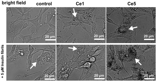Biomedicines | Special Issue : Nanobiomaterials: From Fundamentals to ...