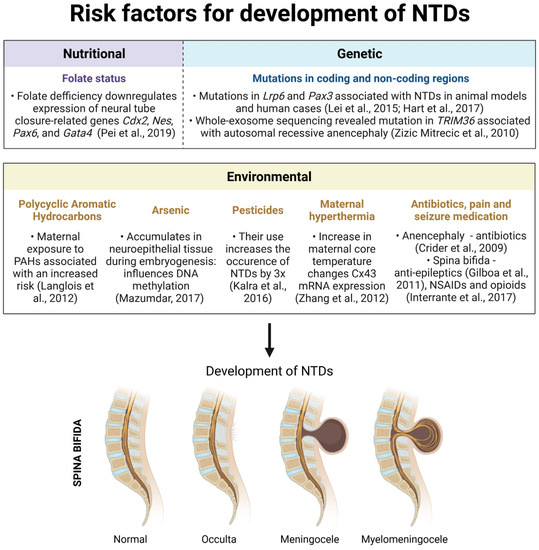 Overview of Neural Tube Defects: Gene–Environment Interactions ...