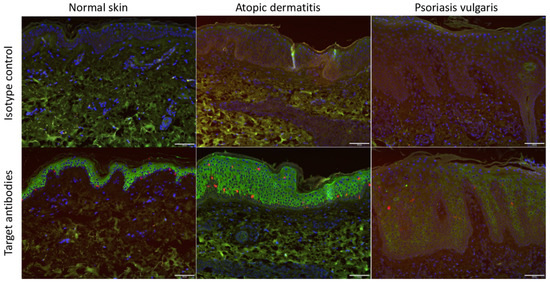 IL-33 Enhances ACE2 Expression on Epidermal Keratinocytes in Atopic ...