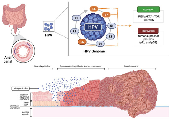 Biomarkers in Anal Cancer: Current Status in Diagnosis, Disease ...