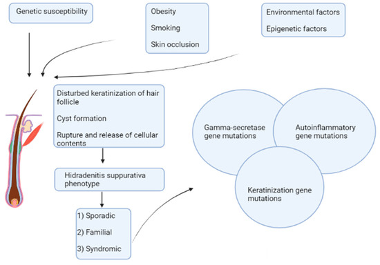 Biomedicines | Free Full-Text | Hidradenitis Suppurativa: A Perspective on Genetic Factors ...