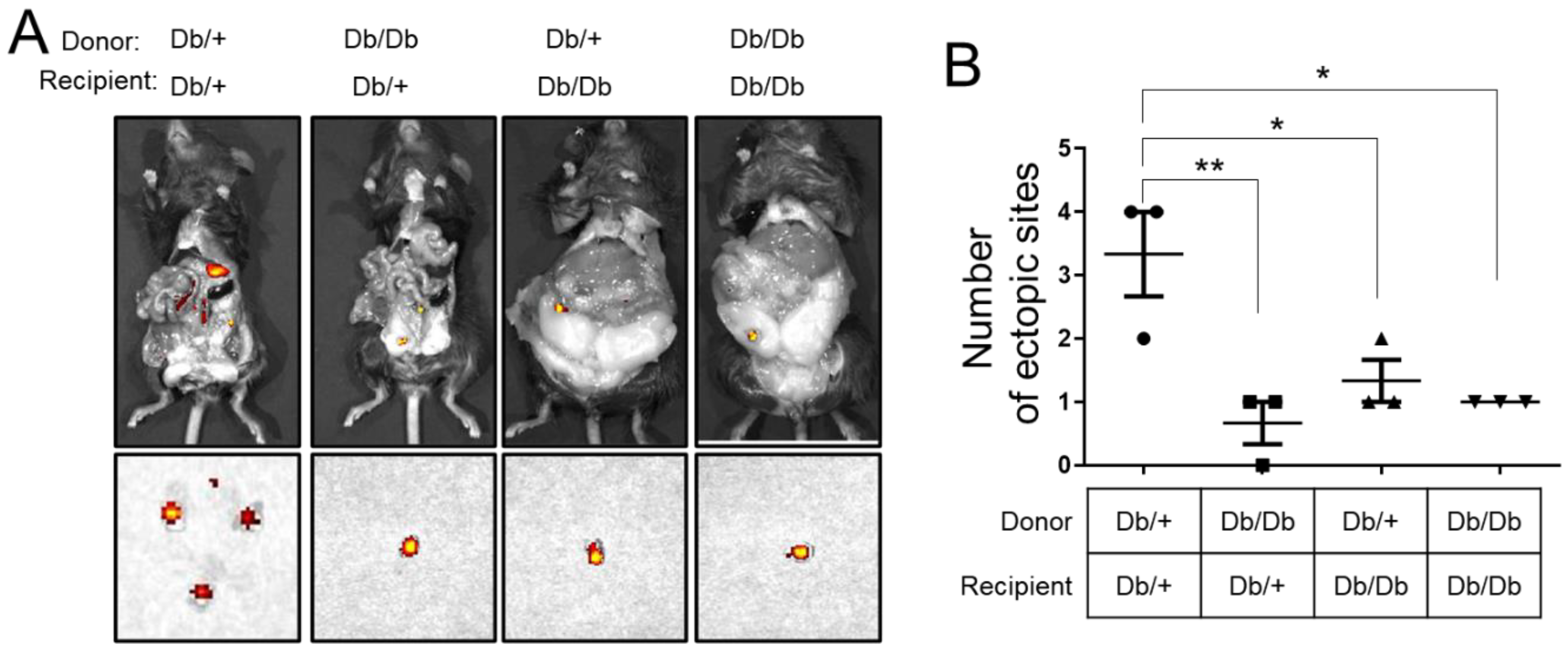 Leptin Stimulates Endometriosis Development in Mouse Models