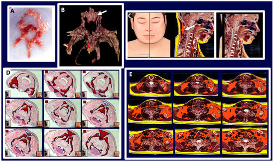 The Adipose Organ Is a Unitary Structure in Mice and Humans