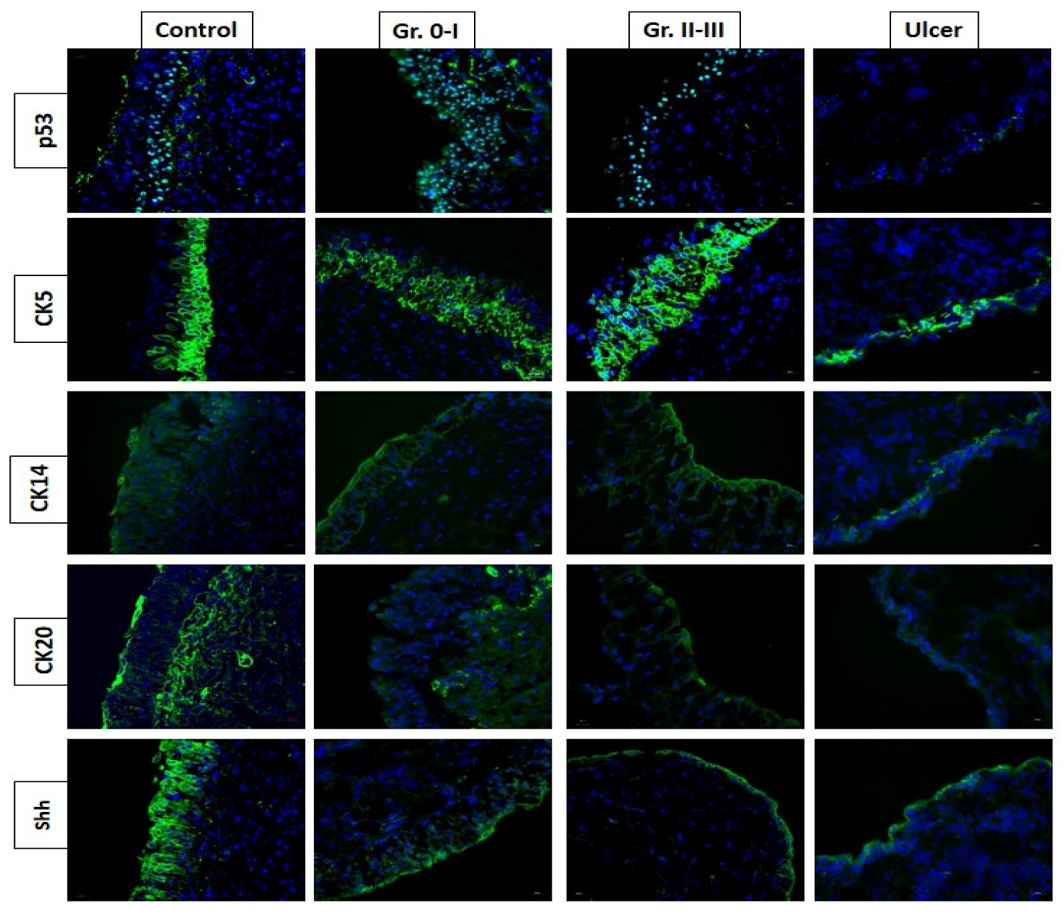 Current Understanding of the Pathophysiology and Novel Treatments of ...