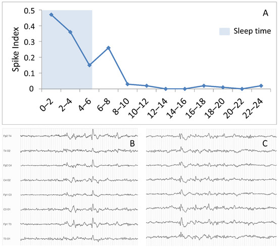 EEG Markers of Treatment Resistance in Idiopathic Generalized Epilepsy ...