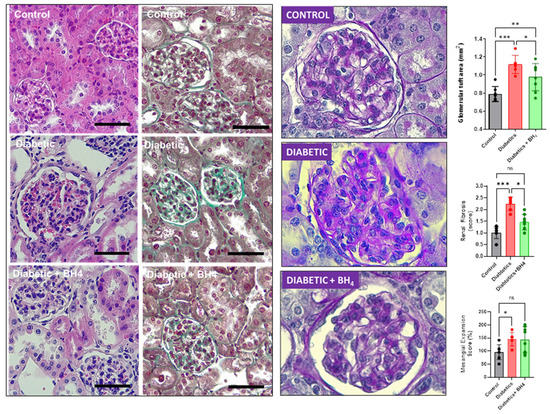 Tetrahydrobiopterin (BH4) Supplementation Prevents the Cardiorenal ...