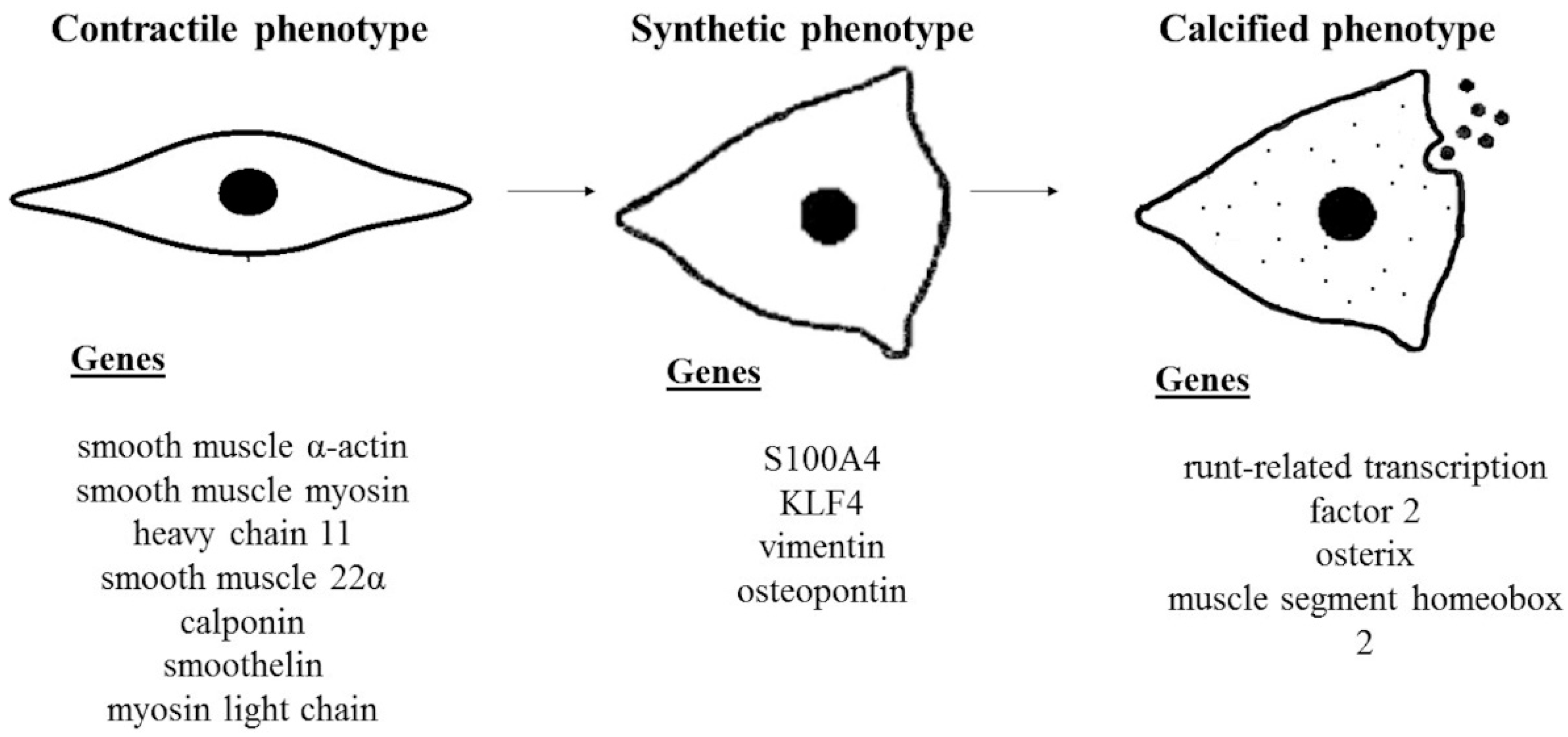 Vascular Calcification: In Vitro Models under the Magnifying Glass