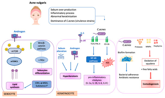 Biomedicines | Free Full-Text | Acne Vulgaris, Atopic Dermatitis and Rosacea: The Role of the ...