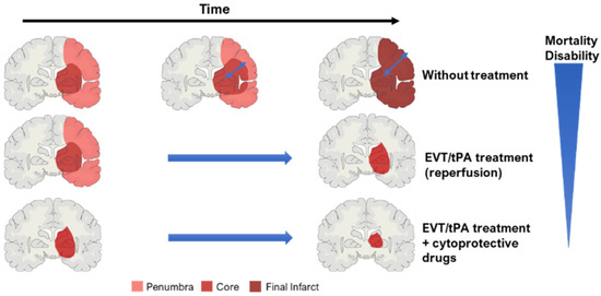 Ischemic Stroke, Lessons from the Past towards Effective Preclinical Models