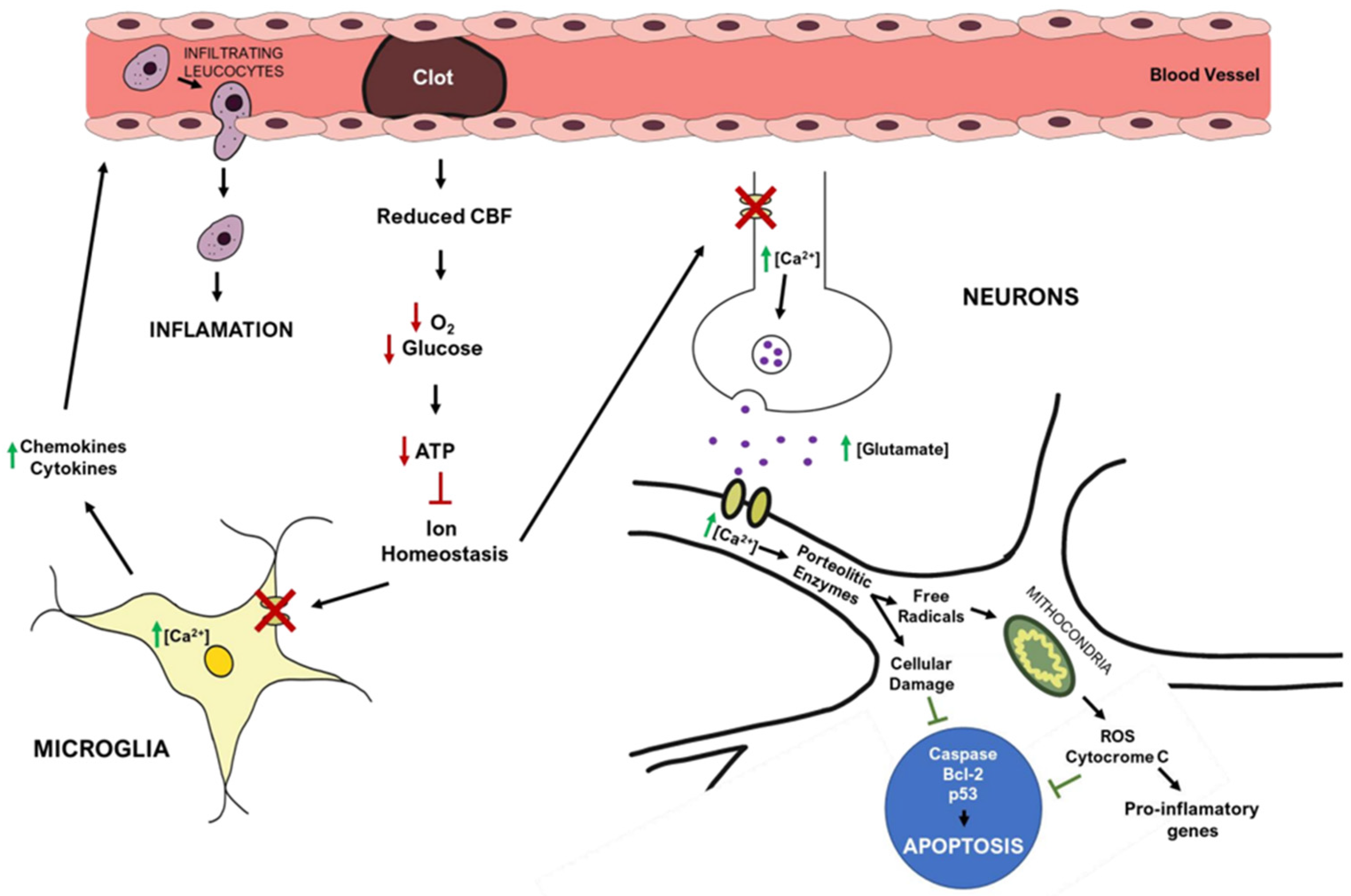Ischemic Stroke, Lessons from the Past towards Effective Preclinical Models