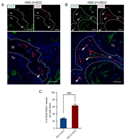 SOD3 Expression in Tumor Stroma Provides the Tumor Vessel Maturity in ...