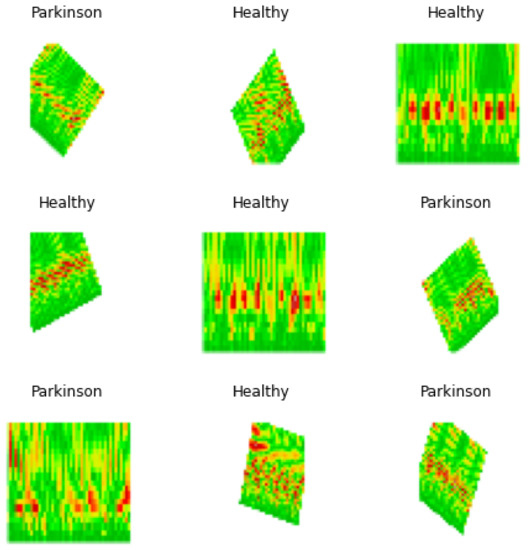 Biomedicines | Free Full-Text | Modified SqueezeNet Architecture for ...