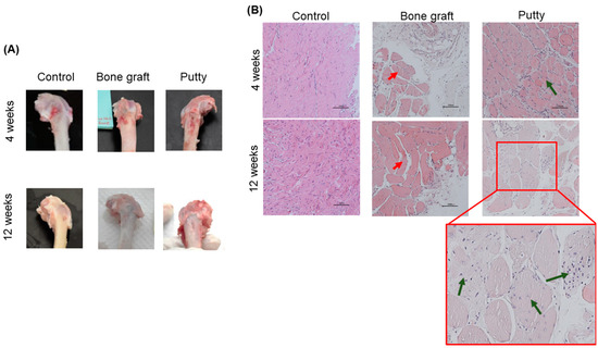 Regenerative Efficacy of Supercritical Carbon Dioxide-Derived Bone ...