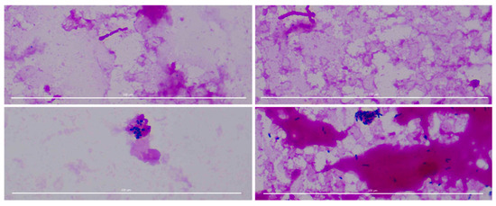 Rapid Convolutional Neural Networks for Gram-Stained Image Classification at Inference Time on ...