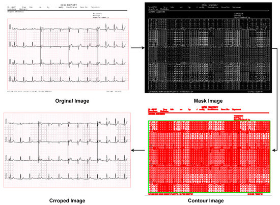 Biomedicines | Free Full-Text | A Robust Framework Combining Image Processing and Deep Learning ...