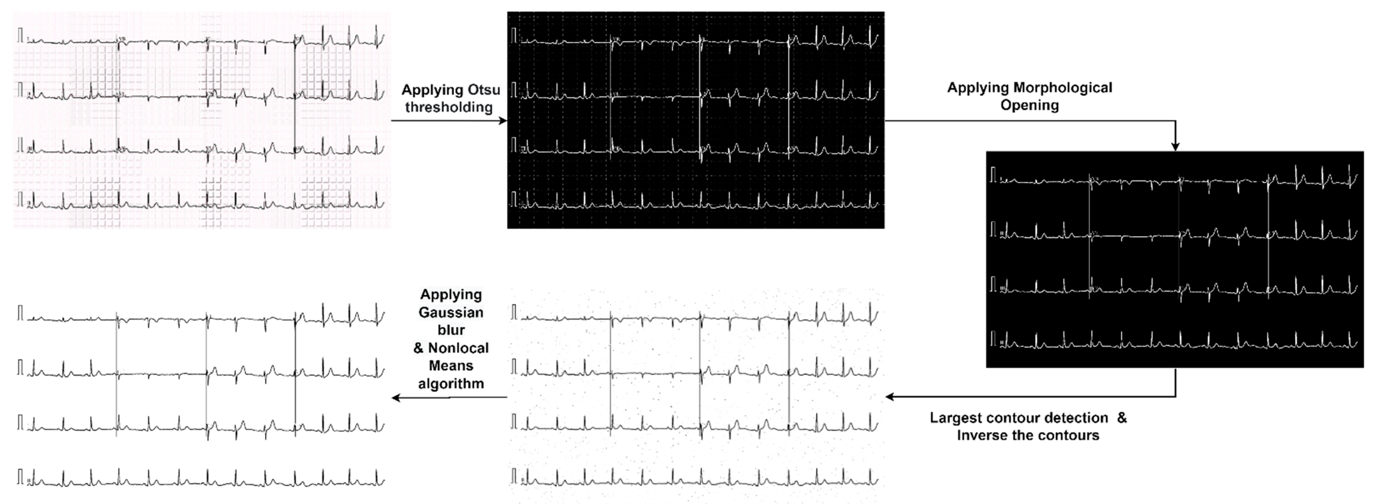 Biomedicines | Free Full-Text | A Robust Framework Combining Image Processing and Deep Learning ...