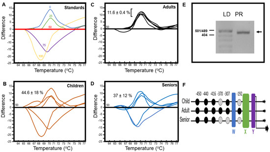 The Immunological Epigenetic Landscape of the Human Life Trajectory