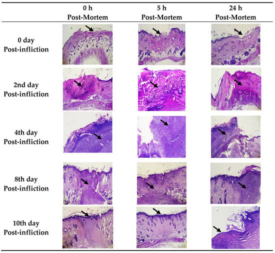 Estimation of Early Postmortem Interval from Long Noncoding RNA Gene ...