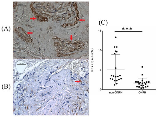 The Antagonism of Neuropeptide Y Type I Receptor (Y1R) Reserves the ...