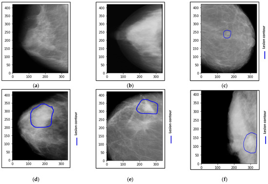 A Hybrid Workflow of Residual Convolutional Transformer Encoder for ...