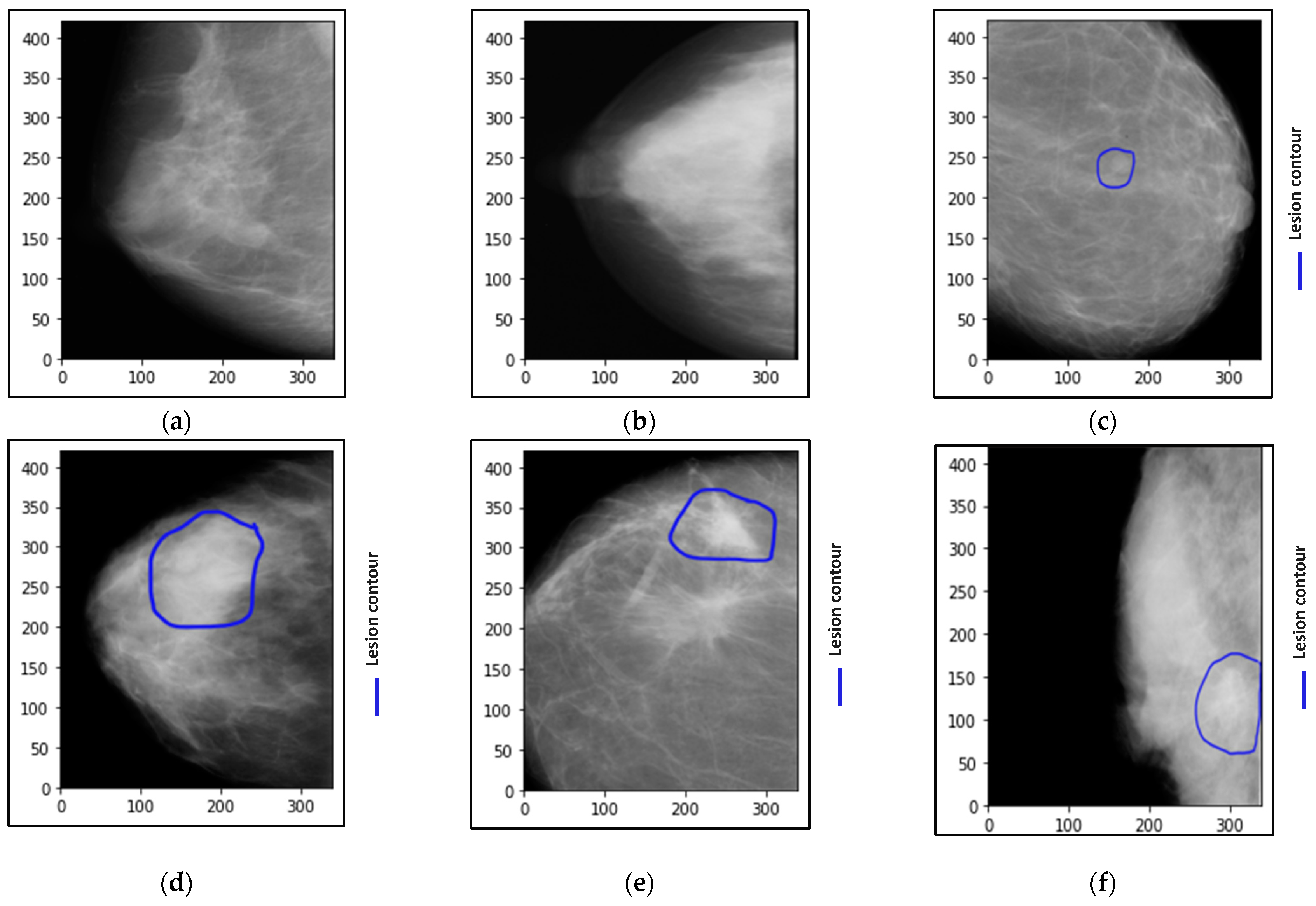 A Hybrid Workflow of Residual Convolutional Transformer Encoder for ...