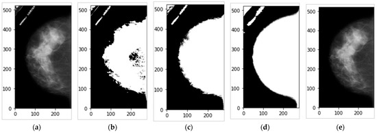 A Hybrid Workflow of Residual Convolutional Transformer Encoder for Breast Cancer Classification ...